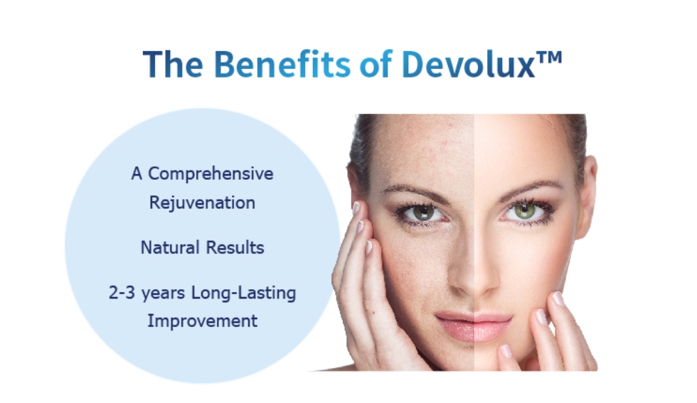 Devolux Filler injectable poly l lactic acid - Dermax